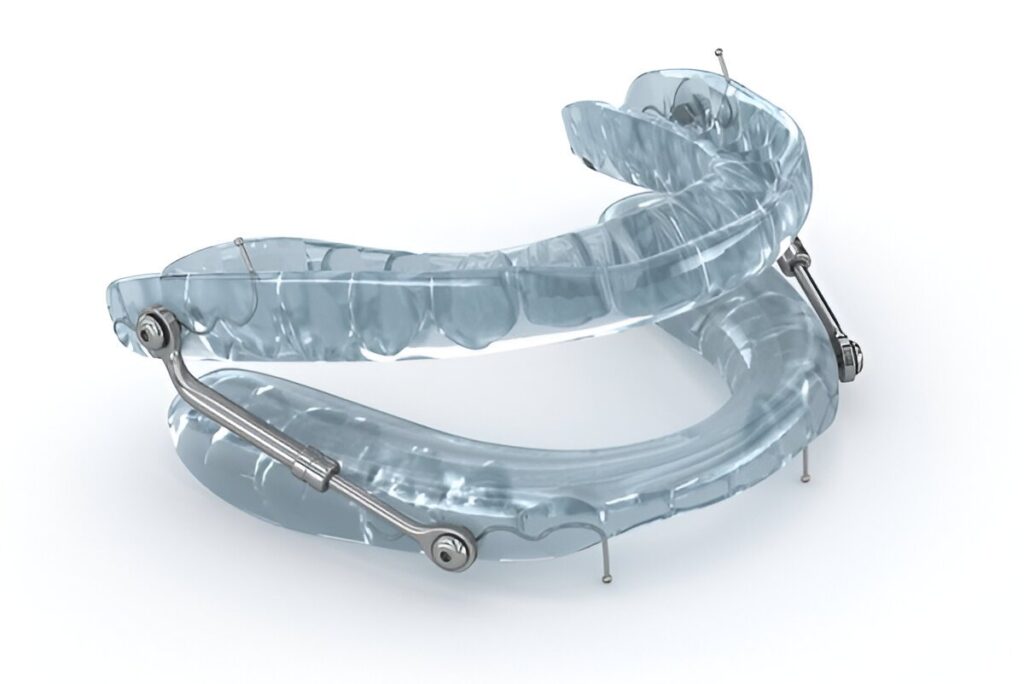 Oral Appliances for TMJ & Sleep in Beverly Hills, CA | Oral Appliances ...